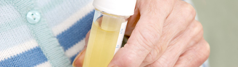 Blood In Urine Healthdirect blood-in-urine-healthdirect