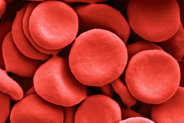 Anaemia - symptoms, causes and treatment | healthdirect