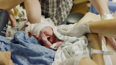 Birth injury (in the baby) | Pregnancy Birth and Baby