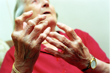 Joint pain and swelling - symptoms, causes and treatments | healthdirect