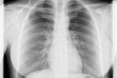 Chest injuries - symptoms, causes and treatments | healthdirect