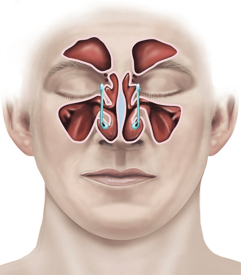 Sinus