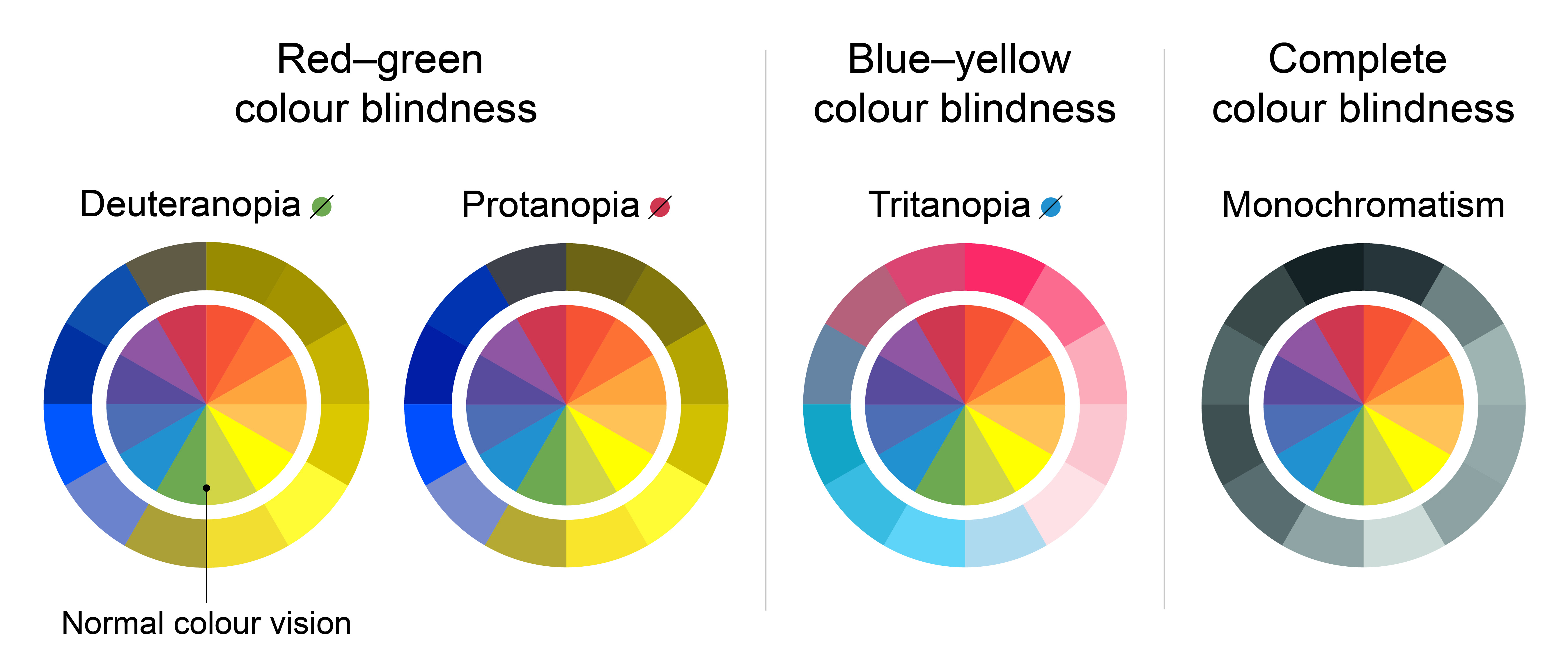 Professione Mammut Dopo Di Che Types Of Blindness Pulire La Camera Da Letto Guerra Stufo