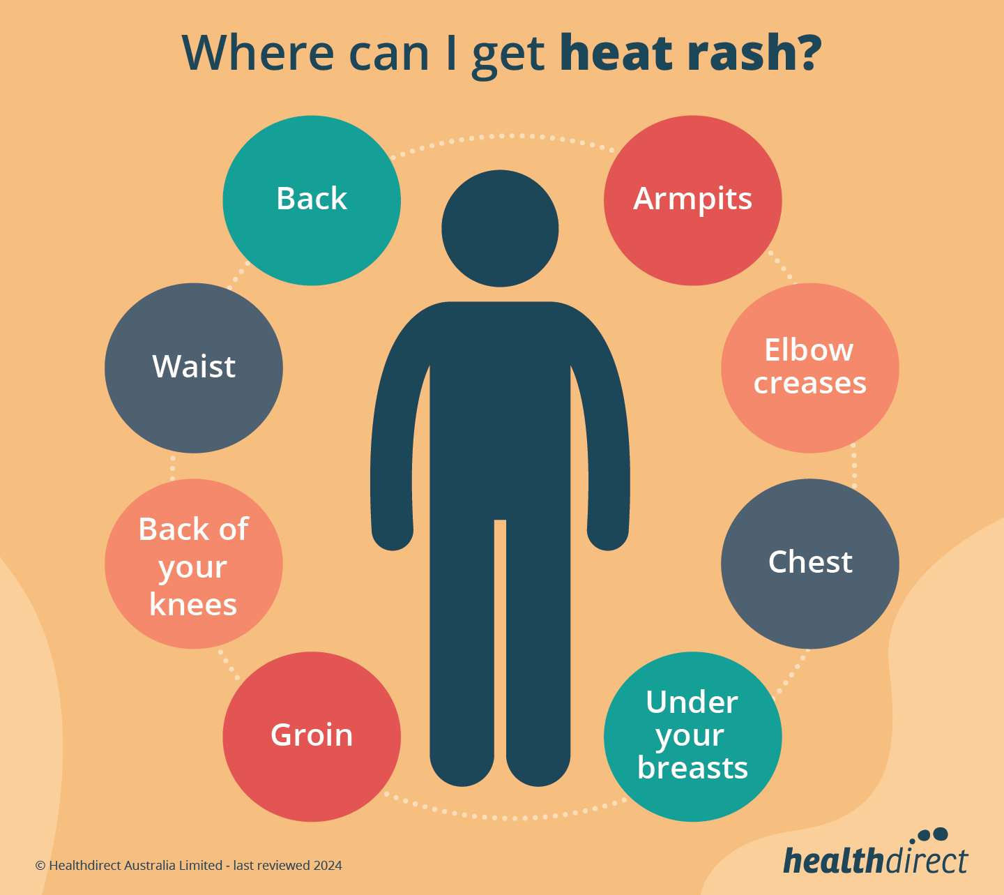 Heat Rash Treatments Symptoms And Causes Healthdirect