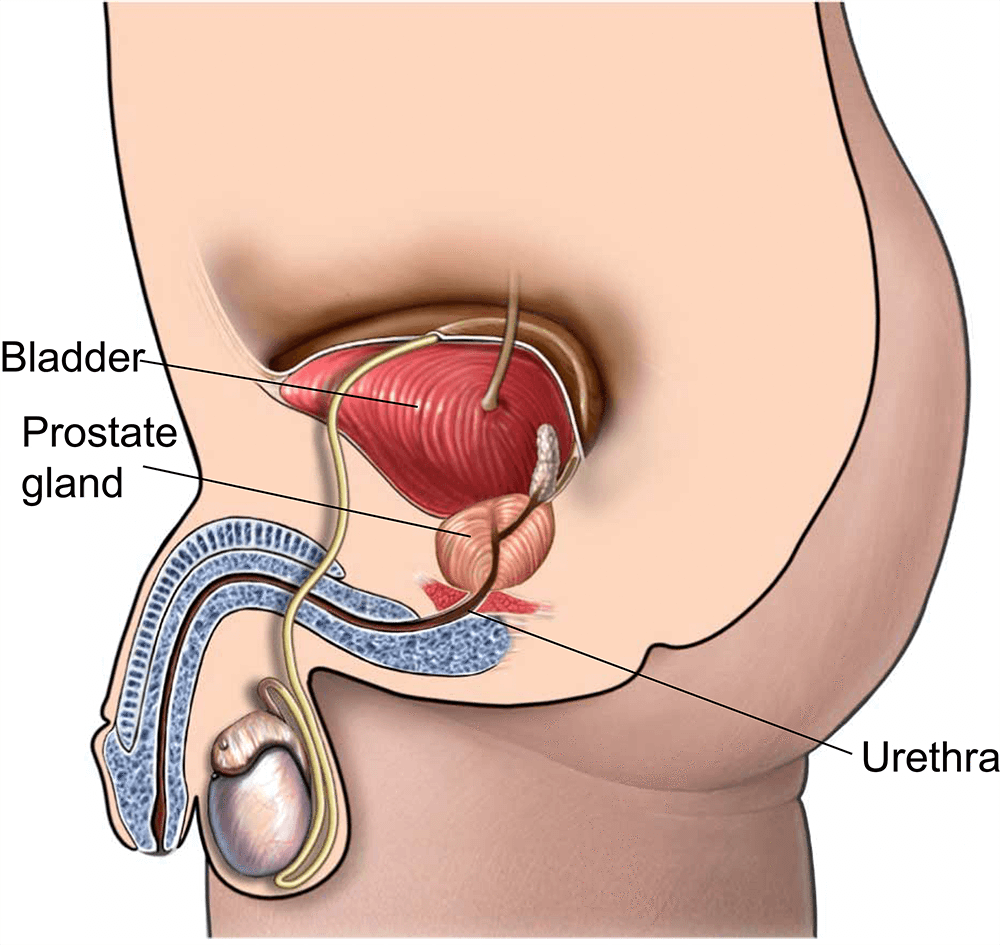 Prostate Cancer Symptoms Treatment And Causes 52 OFF