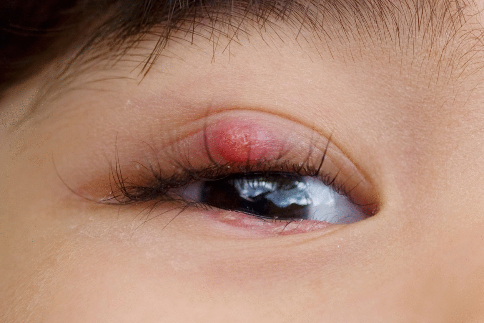Cause of eye stye store