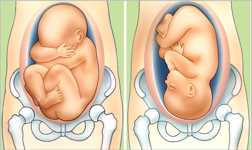 Top 9 How Early Can A Baby Turn Head Down 2022 Top 9 How Early Can A Baby Turn Head Down 2022